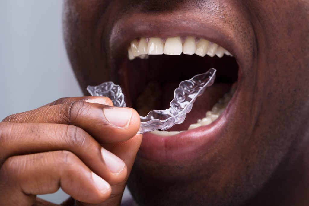 Invisalign Vs Braces Which Is Better Coral Dental Care