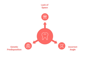 Horizontal Impacted Wisdom Tooth: Causes & Treatment