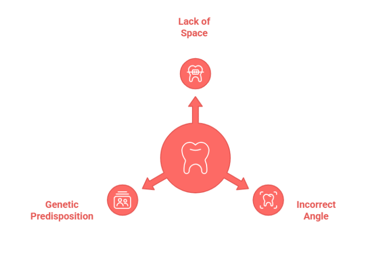 Horizontal Impacted Wisdom Tooth: Causes & Treatment